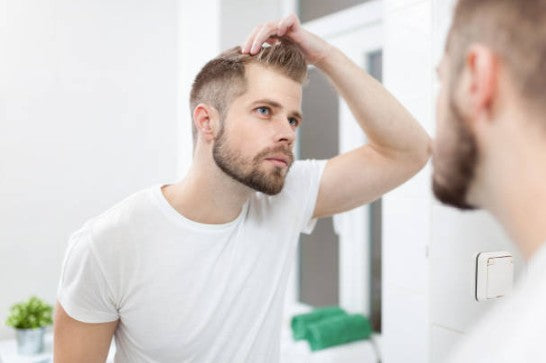 Perte de cheveux - Homme – Kara - Spécialiste en Santé capillaire